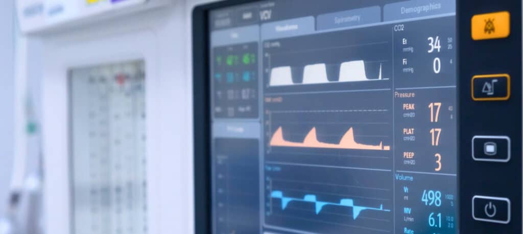 Capnography 101: A Comprehensive Guide to EtCO2 Monitoring for Patient ...