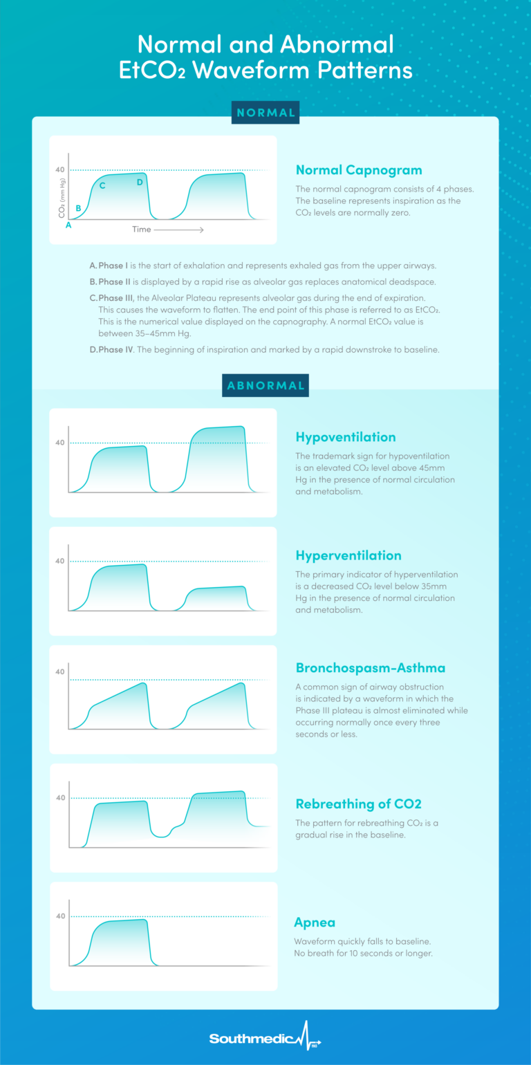 Capnography 101: A Comprehensive Guide to EtCO2 Monitoring for Patient ...